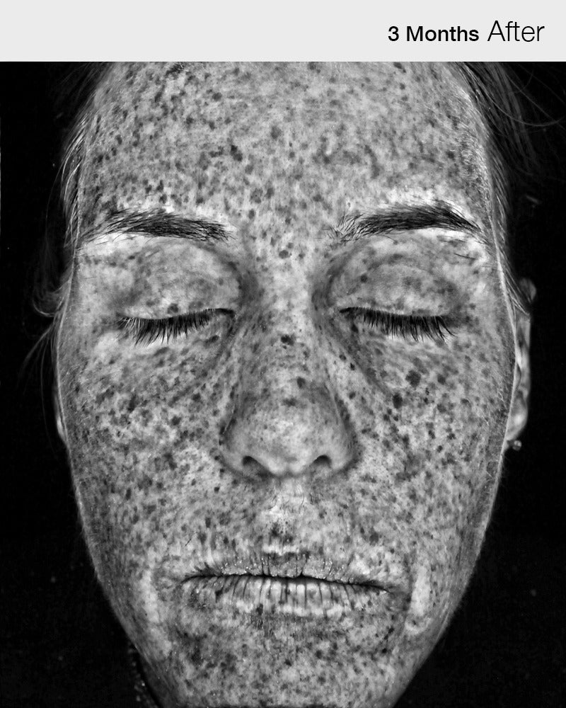 Before and afters - Jan Marini UK